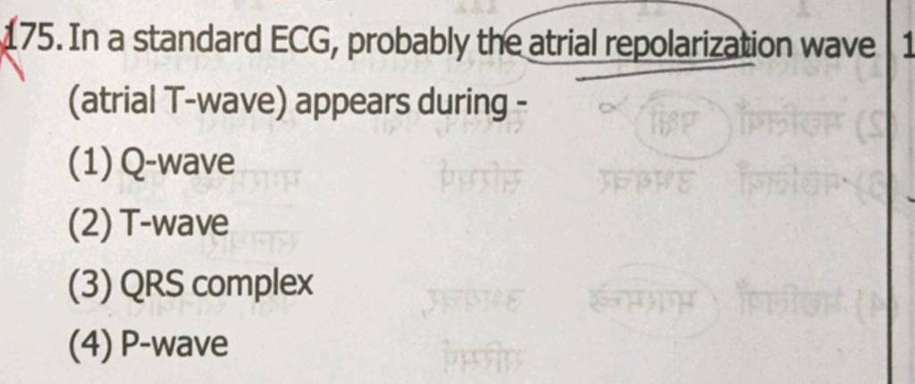 In a standard ECG, probably the atrial repolarization wave 1 (atrial T-wa..